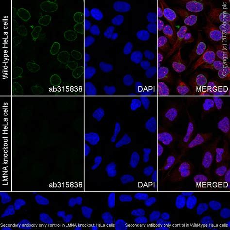 Anti Lamin A Lamin C Antibody Rm1093 Ko Tested Ab315838 Abcam