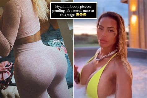 ‘model Traveled To The Caribbean To Get Butt Implants — And They Fell