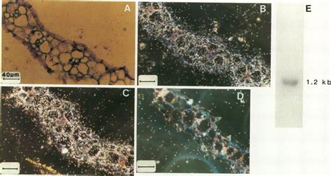 Distribution Of Lhcii Mrna In Maize Leaf Sections Using In Situ