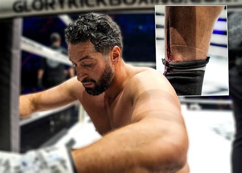 Jamal Ben Saddik Vecht Tegen Tranen In Ahoy Diepe Snee Beëindigt Gevecht ‘gaan Zo Veel Emoties