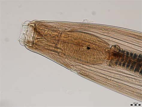 What Is The Most Effective Medium For Clearing Small Strongyle Worms