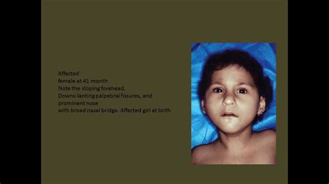 Chromosome Duplication Syndrome