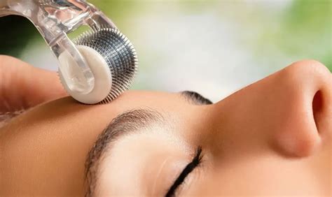 How To Use A Derma Roller Does It Really Work Wishes N Kisses