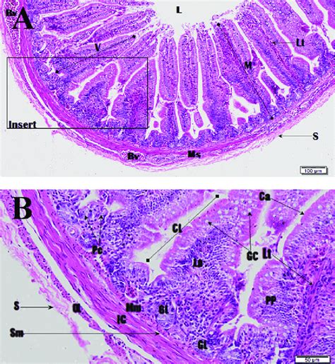 Ileum Microscope Slide Labeled At Natalie Axon Blog