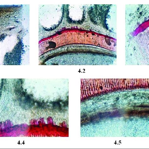 Transverse Section Of Fruit Micro Photograph 31 Epidermis To