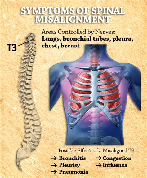 Spinal Misalignment Medizin Gewebe