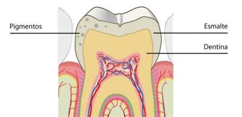 ¿qué Es La Dentina Del Diente ⋆ Odontología