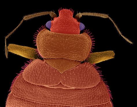 Bed Bug Photograph By Dennis Kunkel Microscopy Science Photo Library Pixels