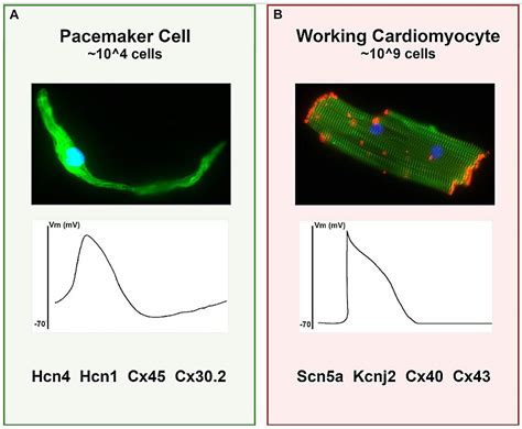 Pacemakercel Wikipedia