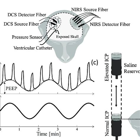 Experimental Setup A Location Of Dcs Catheter And Icp Sensor Download Scientific Diagram