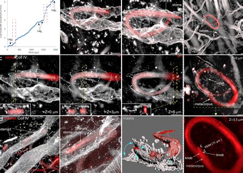Parasite Worms In Humans