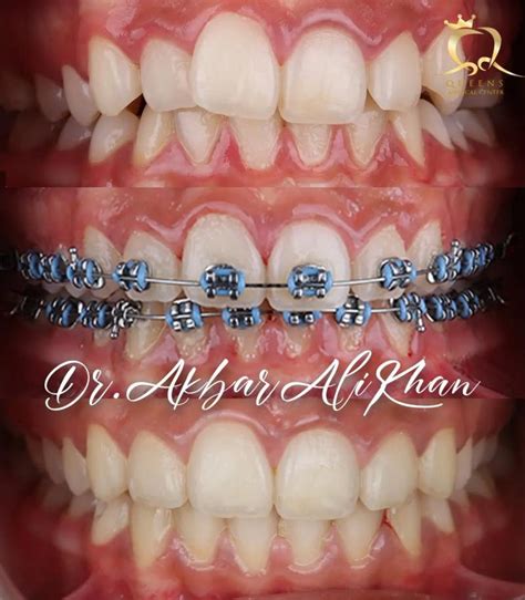 Dr Akbar Ali Khan On Instagram Start To Finish In 10 Months… Dr