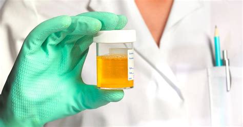 Record Number Of U S Workers Cheating On Drug Tests Quest Diagnostics Finds Cbs News