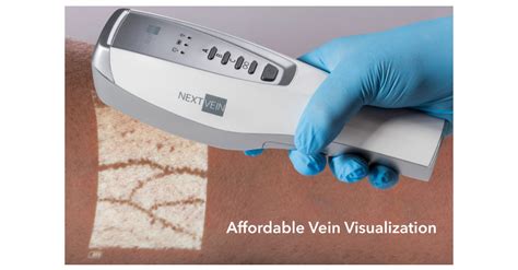 Nextvein Announces Affordable High Performance Handheld Vein