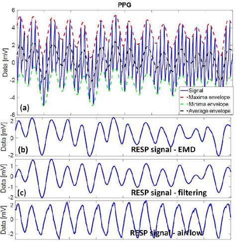Figure 3 From A Portable Multisensor System To Assess Cardiorespiratory Interactions Through