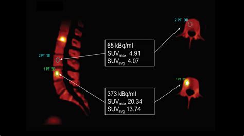 Accurate Reproducible And Standardized Quantification