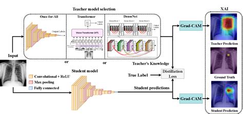 Explainable Knowledge Distillation For On Device Chest X Ray Classification