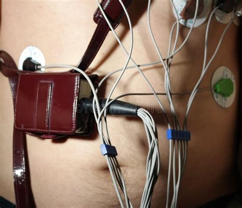 A Man Wearing A Holter Monitor Device For Daily Monitoring Of An