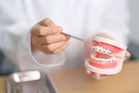 How Much Are Braces Your Guide To Affordable Options Infinite