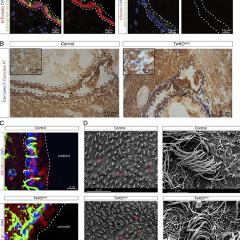 Ependymal Multiciliated Cells Show No Major Abnormality Upon