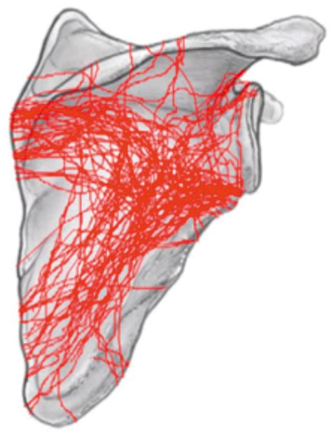 The Scapula—body Glenoid And Process Fractures Clinical Tree
