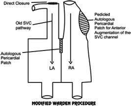Midterm Postoperative Outcomes Of Different Types Of Surgical
