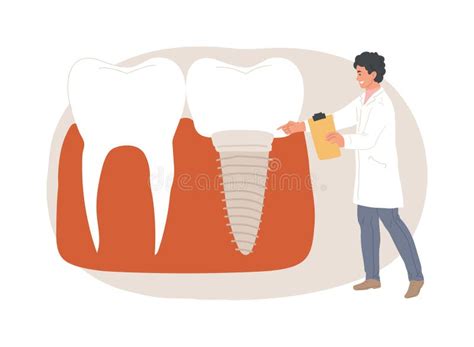 Teeth Dentures Implants Isolated Concept Vector Illustration Stock