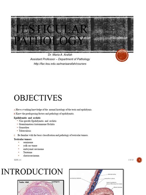 4 Disease Of The Epididymis And Testicular Tumorspdf Download Free