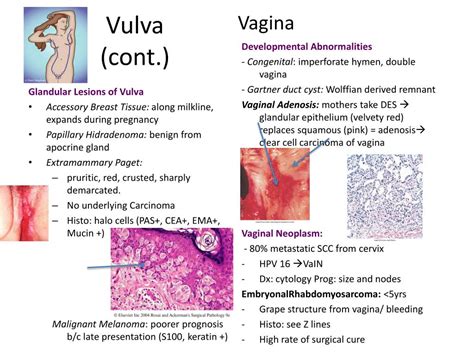 Ppt Female Reproductive Pathology Powerpoint Presentation Free