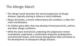Rhinoconjunctivitis In Allergy March Pptx