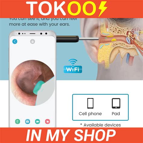 Wireless Smart Ear Cleaning Endoscope Visual Ear Pick Ear Spoon