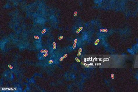 Pneumococcal Virus Photos And Premium High Res Pictures Getty Images
