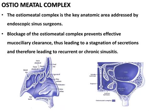 Functional Endoscopic Sinus Surgery Pptx