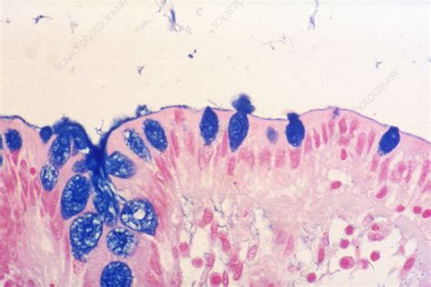 Mucin Goblet Cells Lm Stock Image C0501650 Science Photo Library