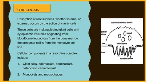 Multiple Idiopathic External And Internal Resorption Dr Sanjana Ravindra Pptx