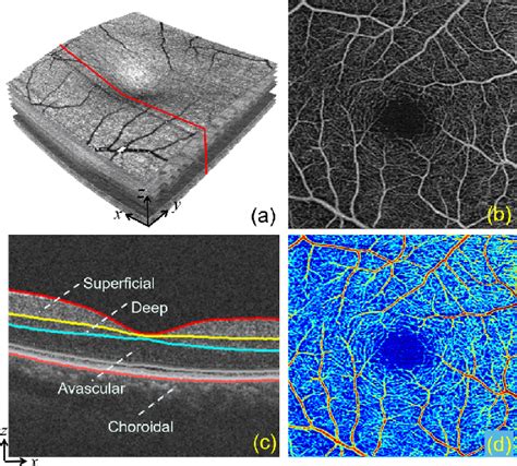 figure 1 from 3d vessel reconstruction in oct angiography via depth map