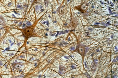 Brain Tissue Stock Image P360 0127 Science Photo Library