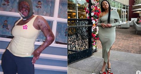 Kechi Okwuchi Marks 19 Years Of Surviving Sosoliso Plane Crash