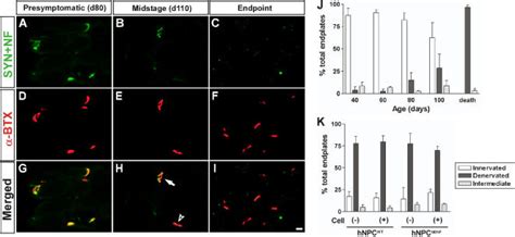 Axons Were Identified With Synaptophysin And Neurofilament Synnf