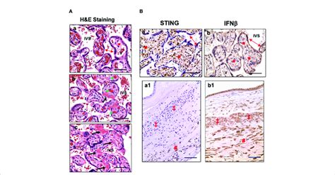 Representative Villous Tissue Hande Staining And Expression Of Sting And