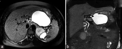 Case Reports In Clinical Radiology Current Issue