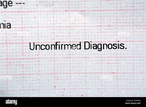 Ecg Electrocardiograph Paper That Shows Unconfirmed Diagnosis Of Abnormal Cardiac Electrical