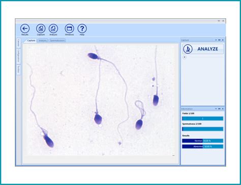 Sca® Morphology Sperm Analysis With A Casa System Microptic
