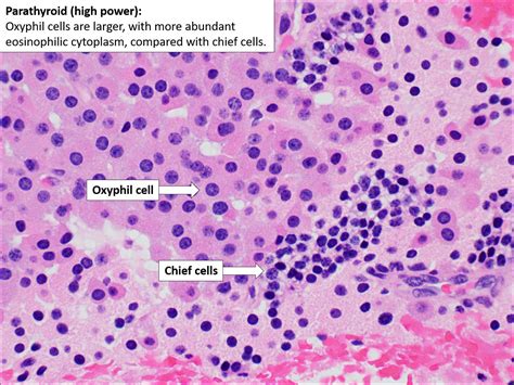 Parathyroid Normal Histology Nus Pathweb Nus Pathweb
