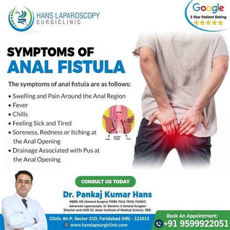 Fistula In Ano Symptoms And Signs