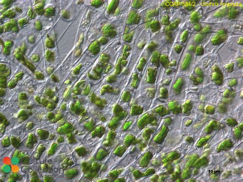 Ulothrix Under Microscope