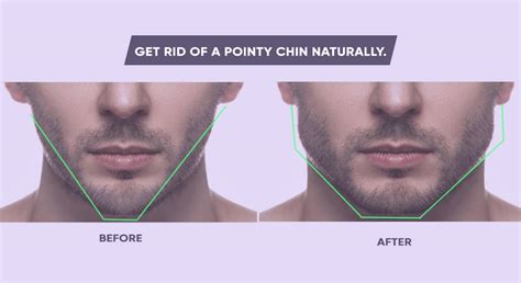 How To Get Rid Of A Pointy Chin If Its Too Visible To Your Liking
