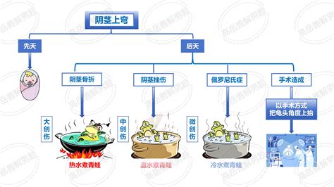 【阴茎弯曲：认识】龟头上翘——阴茎上弯是最优配置还是疾病？男性生殖器畸形男性生殖器畸形治疗方式 好大夫在线