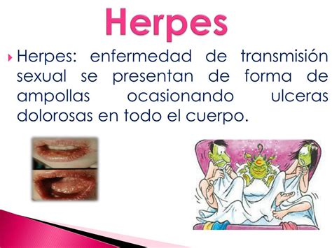 Ppt Infecciones De Trasmisión Sexual Powerpoint Presentation Free