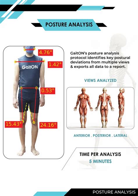 Digital Posture Analysis System Gaiton At Best Price In Delhi Id 2854248626262
